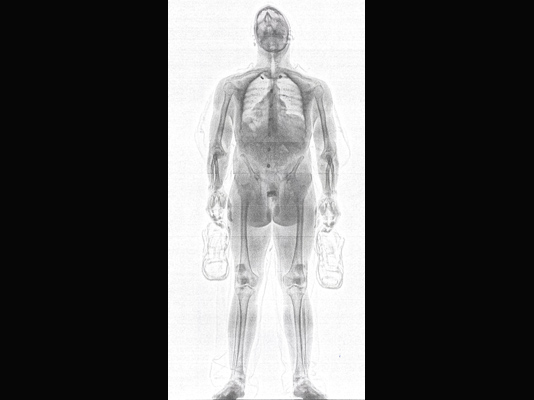 Body scan reveals phone in inmate's rectum | wtsp.com