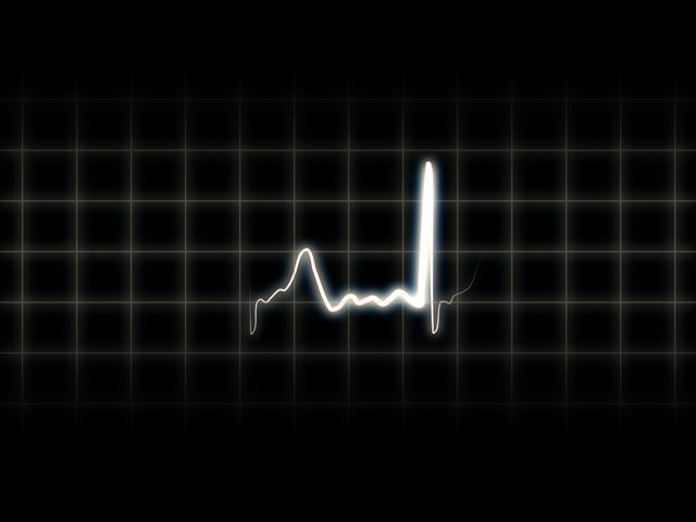 Florida woman survives 45 minutes with no pulse | wtsp.com