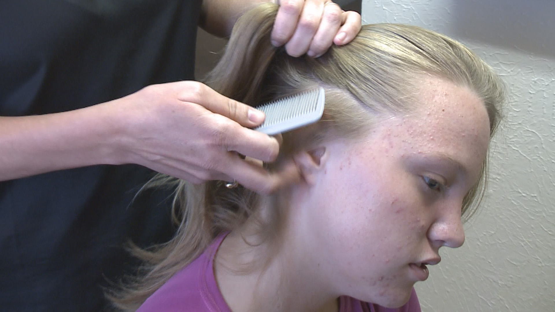Super lice outbreak before start of school | wtsp.com