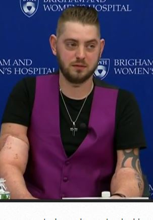 Former Marine maimed in action grateful for arm transplant | wtsp.com