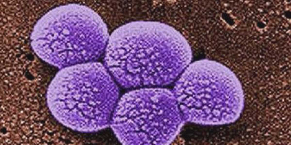 Are superbugs more common than we've been told? | wtsp.com