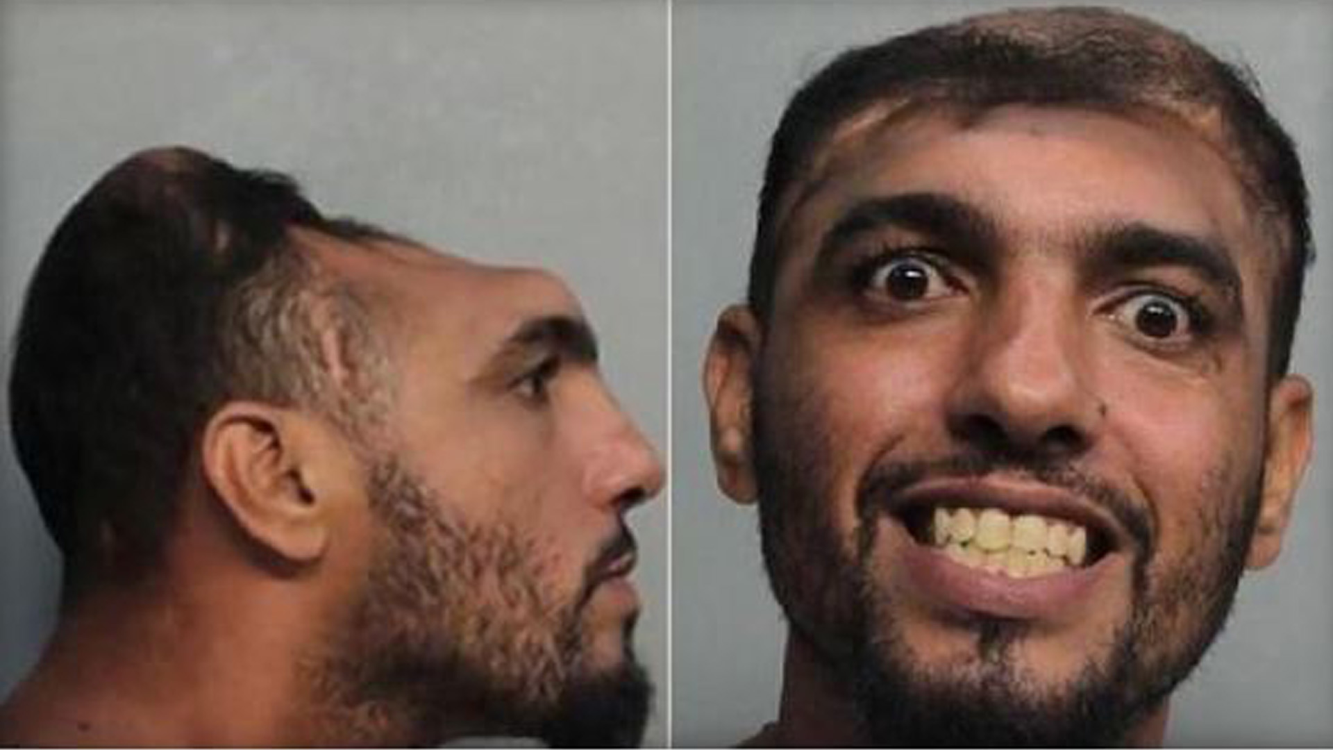 Man with severely deformed skull faces arson, murder charges | wtsp.com