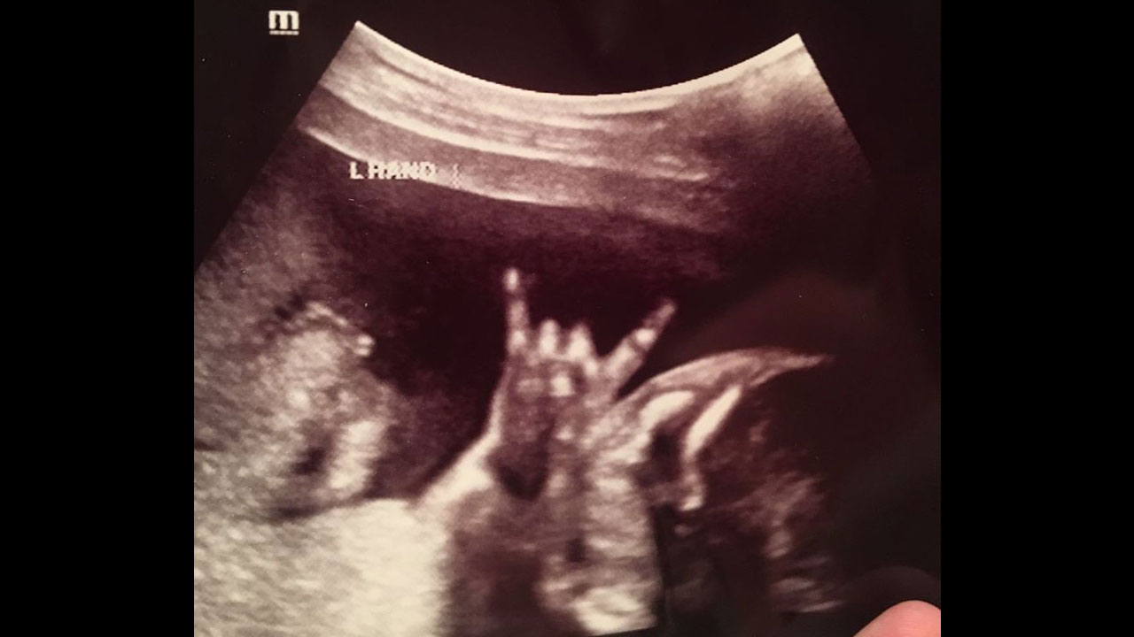 Rock On! Ultrasound Shows a Party in the Womb | wltx.com